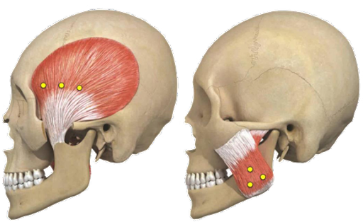 TMJ Therapy in Alexandria | King Centre Dental